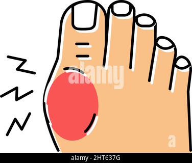 pain in big toe color icon vector illustration Stock Vector Image & Art ...