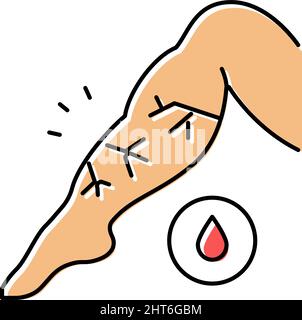 Venous disease edema color line line icon. Vector varicose vein and ...