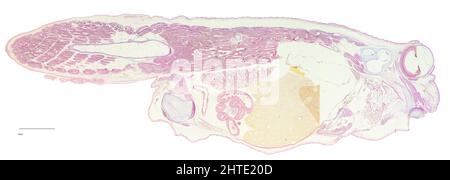 Tadpole Metamorphosis, A series of microscope slide sections taken of ...