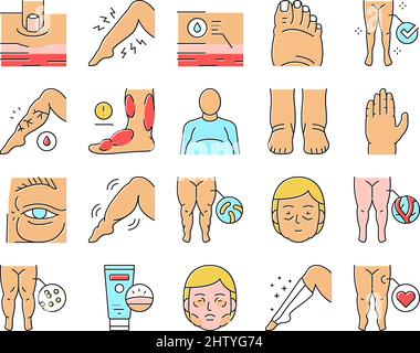 Edema Disease Symptom Collection Icons Set Vector Stock Vector Image ...