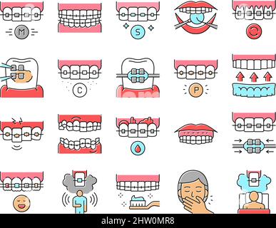 Tooth Braces Accessory Collection Icons Set Vector Stock Vector Image ...
