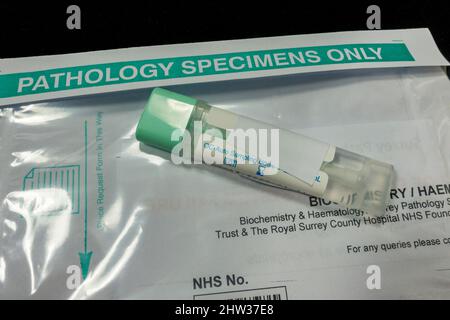 A OC-Auto Sampling Bottle for collecting a stool samples used by the ...