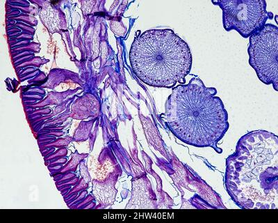 Ascaris lumbricoides female showing intestine, ovaries and uterus with ...