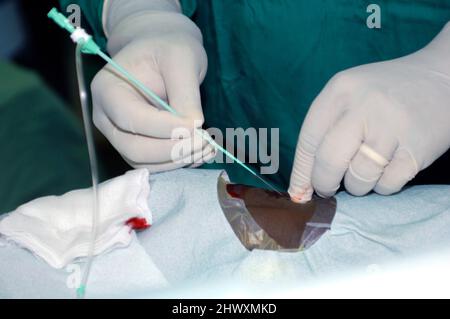 The cardiologist inserts a slightly rigid arterial introducer sheath ...