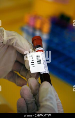 A pathologist labels blood samples in a test tube Stock Photo - Alamy