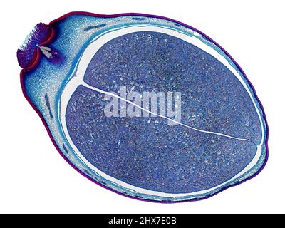 cross section cut under the microscope – microscopic view of plant ...