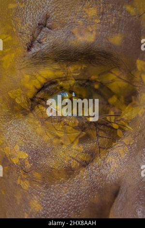 Middle age white woman with stitches above her eye due to a fall Stock ...