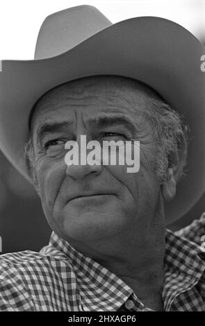 U.S. President Lyndon Baines Johnson displays the incision from his ...