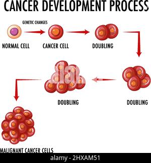 Process of cancer cell development illustration Stock Vector Image ...