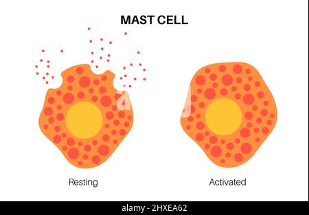 Mast cell, illustration Stock Photo - Alamy