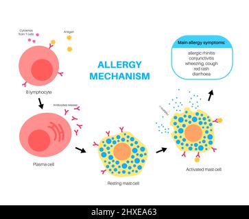 Allergic conjunctivitis, illustration Stock Photo - Alamy