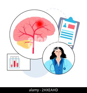 Stroke research, illustration Stock Photo - Alamy