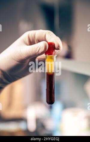 Extraction of plasma from blood Stock Photo - Alamy