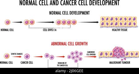 Diagram showing normal and cancer cells in human illustration Stock ...