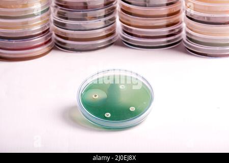 collection of culture plates contain growth of microorganisms on ...