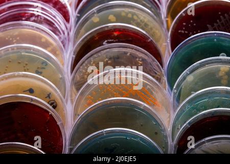 collection of culture plates contain growth of microorganisms on ...