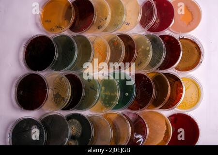 collection of culture plates contain growth of microorganisms on ...