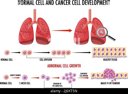 Diagram showing normal and cancer cells illustration Stock Vector Image ...