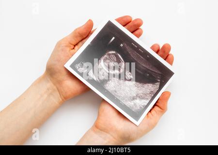 Womans hands holding ultrasound scan of unborn baby. Pregnancy ...