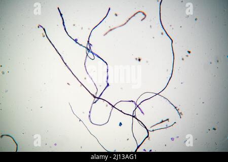 Tissue fibers from the crime scene under a microscope. Physical ...