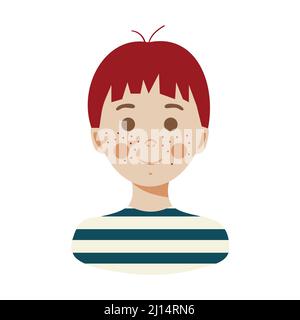 Boy with freckles and ginger hair, illustration, vector on a white ...