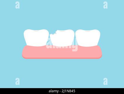 Fractured, chipped tooth in cartoon flat style. Vector illustration of ...