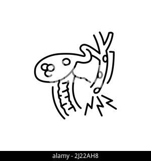 Chronic cholecystitis color line icon. Human diseases. Pictogram for ...