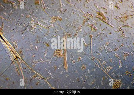 Fossil diatoms,radiolaria,sponge spicules, Barbados 1800's rich ...