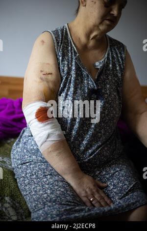 Wounded mother, Svetlana 55 yo, and her daughter, Lydia 32 yo, survived ...