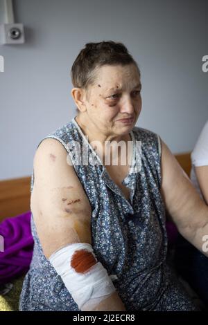 Wounded mother, Svetlana 55 yo, and her daughter, Lydia 32 yo, survived ...