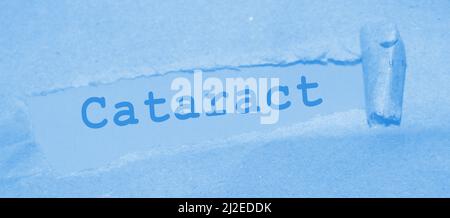 Cataract word written under brown torn paper. Eyes healthcare concept ...