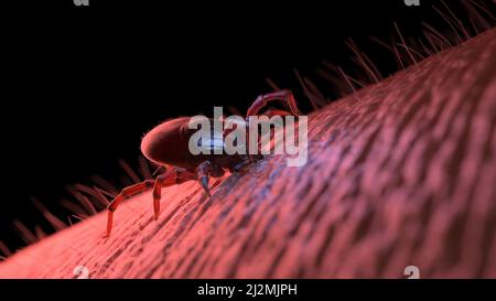 Tick biting human skin, illustration Stock Photo - Alamy