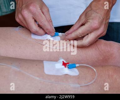 Subcutis of skin Stock Photo - Alamy