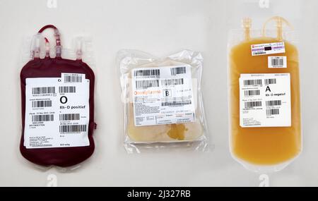 A bag for infusion with extract of Platelets, also called thrombocytes ...