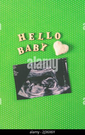 Ultrasound picture of a baby photograph. Selective focus Stock Photo ...