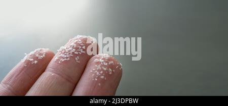 Micro plastic particles on a human finger for scale. Concept for water ...