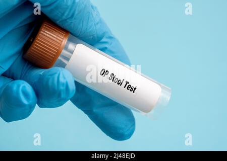 Stool Ova And Parasite (O&P) Test This test is used to identify the ...