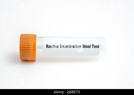 Routine Examination Stool Test Stock Photo - Alamy