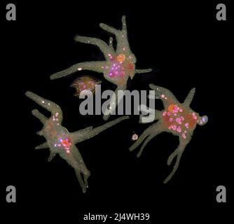 Amoeba Proteus, stained specimens, darkfield photomicrograph Stock ...