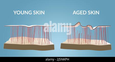 The diagram of younger skin and aging skin Stock Photo - Alamy