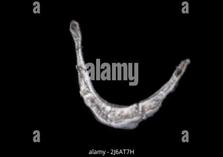 Fractured hyoid bone, 3D CT scan Stock Photo - Alamy