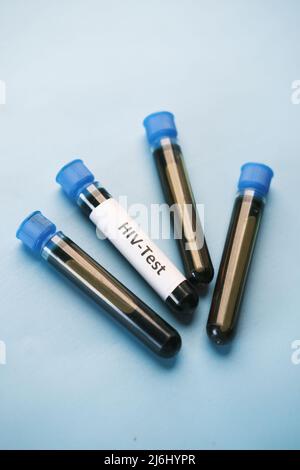 HIV blood test tube and prescription on table Stock Photo - Alamy