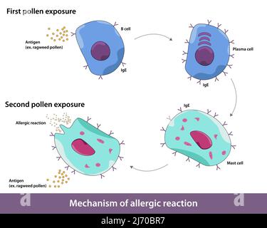 Mechanism of allergy. Mast cells and allergic reaction. Histamine ...
