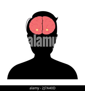 Brain amygdala anatomy, illustration Stock Photo - Alamy