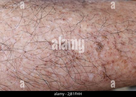 Age, or liver, spots on an elderly woman's hand Stock Photo - Alamy