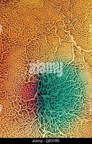 Scanning electron microscope image of a breast cancer cell Stock Photo ...