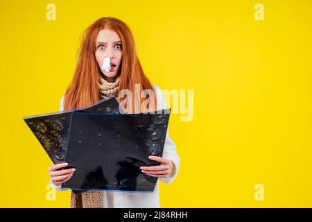 unwell redhaired ginger woman runny nose wearing knitted sweater and ...