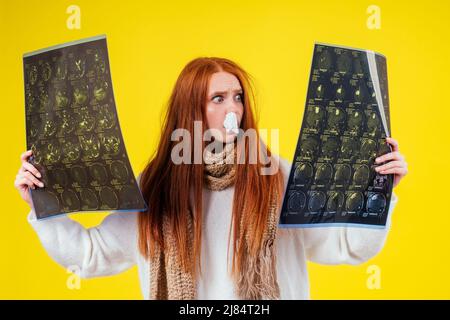 unwell redhaired ginger woman runny nose wearing knitted sweater and ...