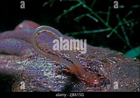 Guinea worm emerging from an ulcerated skin Benin Stock Photo - Alamy