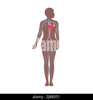 Femoral central venous catheter, illustration Stock Photo - Alamy